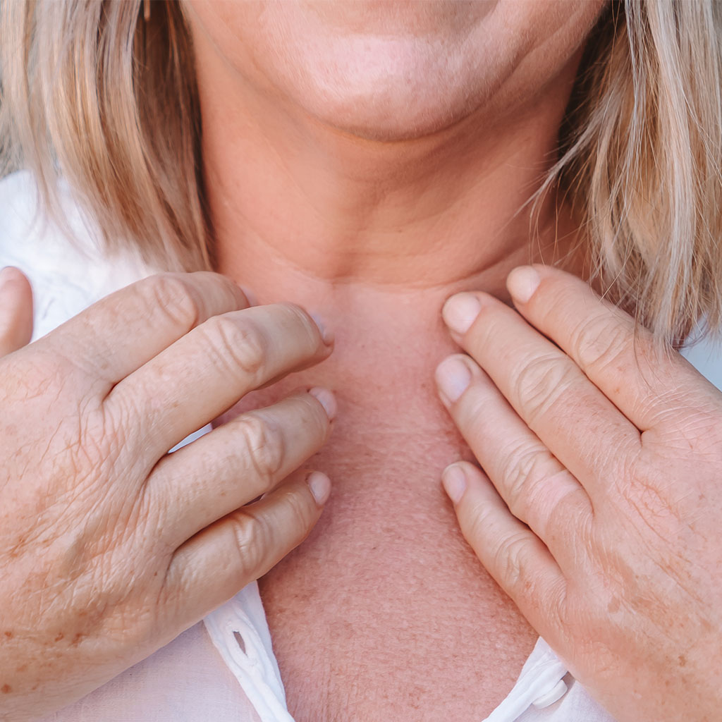 Hypothyroidism Fact Sheet - Sally-Ann Creed